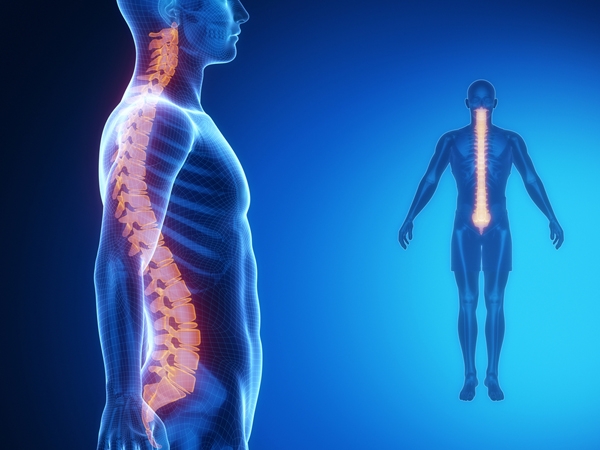Causes, Diagnosis, Prevention and Treatment of Lordosis | Healthy ...