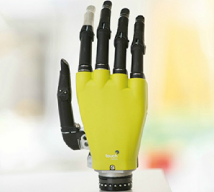 Indian Researcher Makes Touch Sensitive Prosthetic Arm That Could Give ...