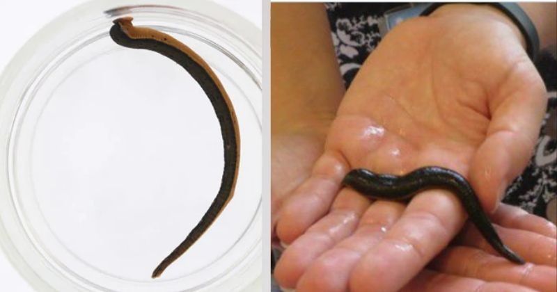 Blood sucking Leech:This New Species Of Leech Has Three Jaws & 59 Teeth ...